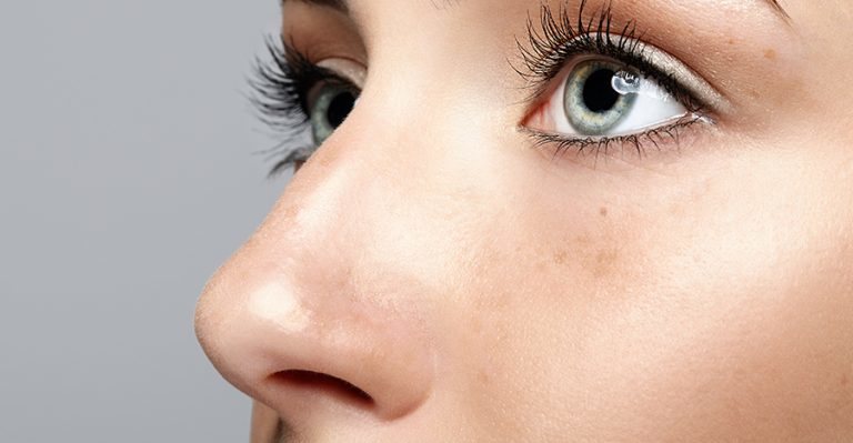 Refine Facial Balance and Breathing with Nose Reshaping in Chico, CA ...