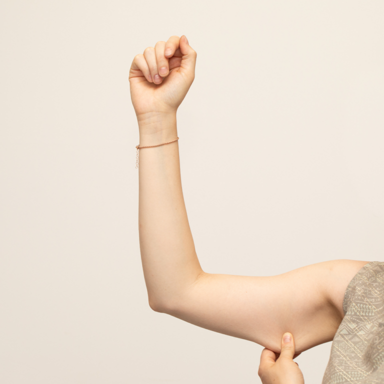 What Results Can You Expect from an Arm Lift Procedure? - Northstate ...